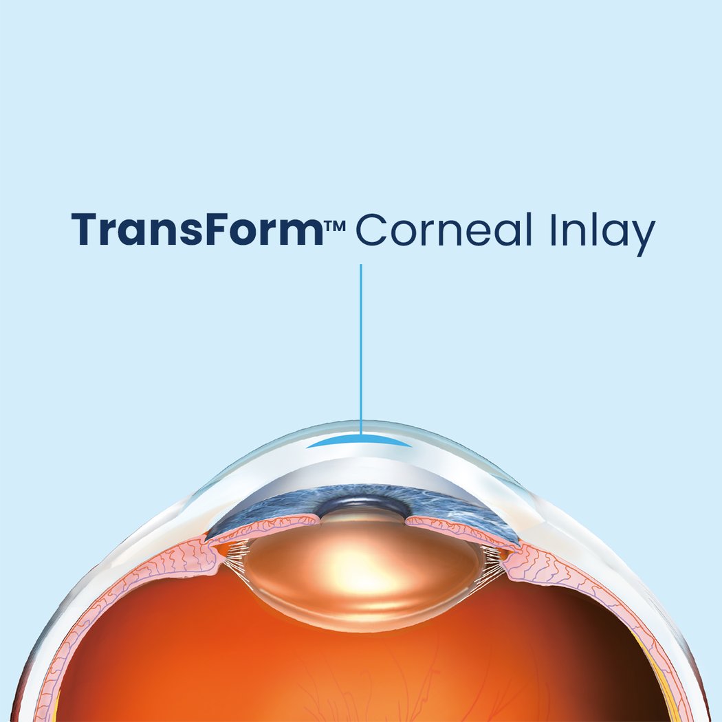 Vision | Clarion Medical Technologies