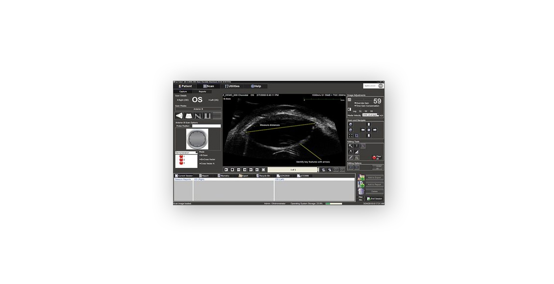 Ellex Eye Cubed™ Ophthalmic Ultrasound